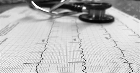 La Ia No Reemplazará A Los Médicos De Urgencias A Corto Plazo Según Un