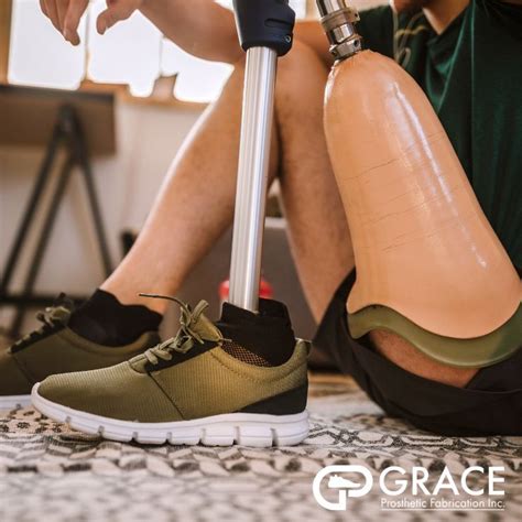 Prosthetic Leg Socket Problems Helping Patients Solve Issues