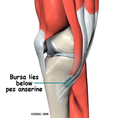 Physical Therapy In Clermont For Knee Pes Anserine Bursitis