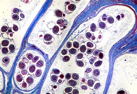 Tapeworm Cyst Light Micrograph Stock Image C0116243 Science