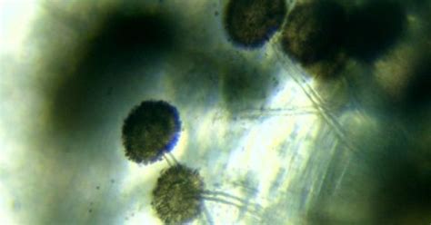 Rhizopus Stolonifer Microscope