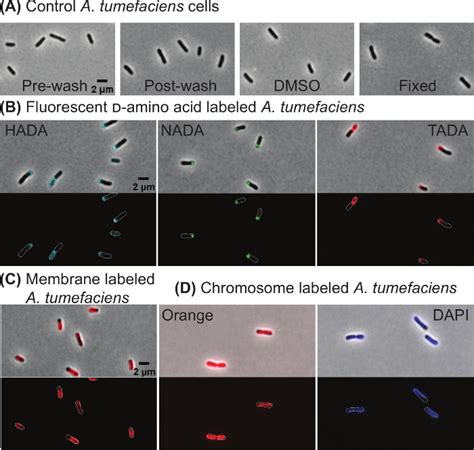 Live Cell Fluorescence Microscopy To Observe Essential Processes During