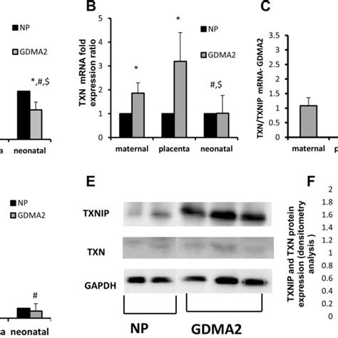 Txnip And Txn Mrna And Protein Expression Mrna Was Isolated From Download Scientific Diagram