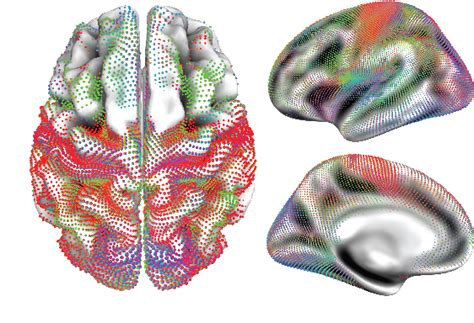 Figure 2 From Functional Connectivity Glyphs For Brain Visualization Semantic Scholar
