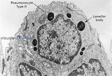 Type 2 Alveolar Cells My Xxx Hot Girl