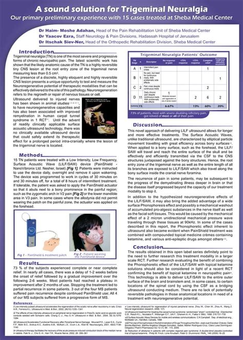 Trigeminal Neuralgia Pdf