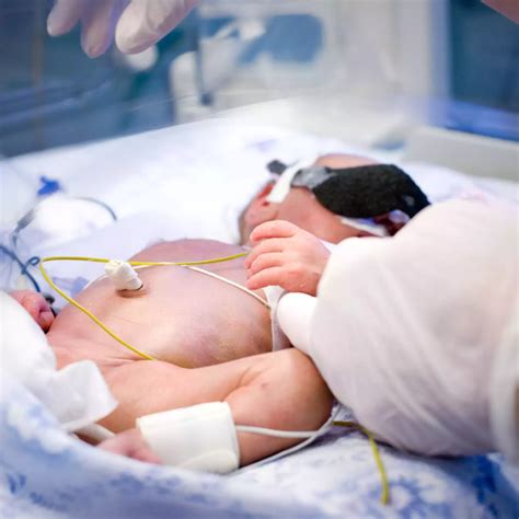 Infant Undergoes Metal Free Spine Fixation Surgery At Aiims A