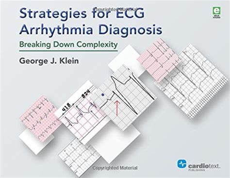 Strategies For Ecg Arrhythmia Diagnosis Breaking Down Complexity Pdf