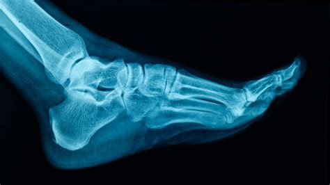 WHATS THE DIFFERENCE BETWEEN CT AND X RAY Mayfair Diagnostics