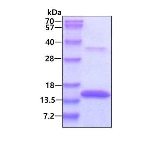 重组人thioredoxin Trx蛋白ab95319 Abcam中文官网