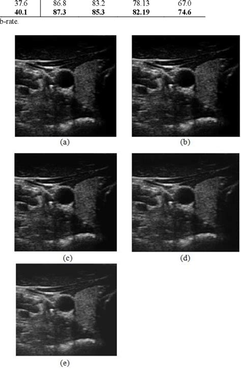 Figure 2 From Ultrasound Compressive Sensing Using Bcs Focuss Semantic Scholar