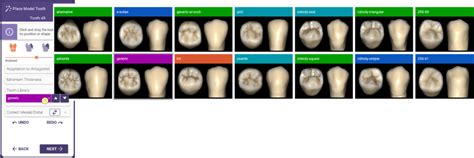 Place Model Tooth Exocad
