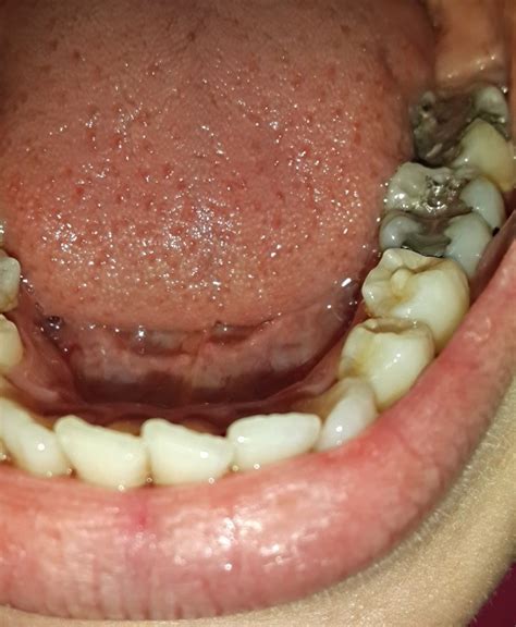 Dentist Fetish Man — I Love Amalgam Fillings