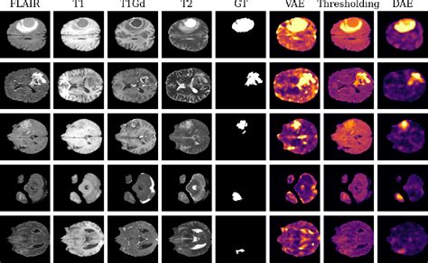 Figure 3 From Denoising Autoencoders For Unsupervised Anomaly Detection