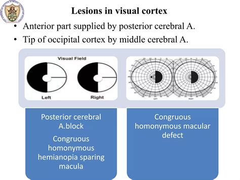 Anatomy Of Lateral Geniculate Body And Visual Cortex Pptx