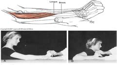 Wrist MMT And Goniometry Flashcards Quizlet