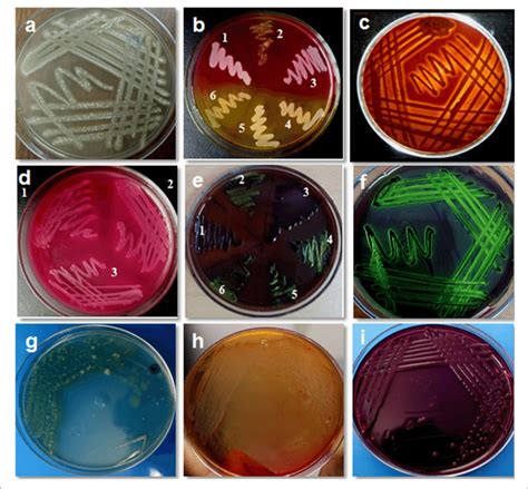 Isolation And Cultural Characteristics Of Bacterial Isolates From