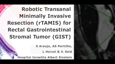 Robotic Transanal Resection Rtamis Of Rectal Gastrointestinal Stromal Tumor Gist Youtube