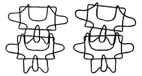 The Yoke Of Chiropractic Vertebral Subluxation Doctrine Science