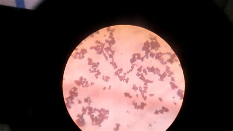 Staphylococcus Haemolyticus Youtube