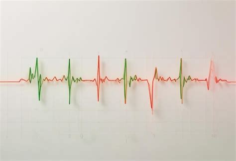 3d Ecg Line Mockup Template For Cardiology And Medical Presentations