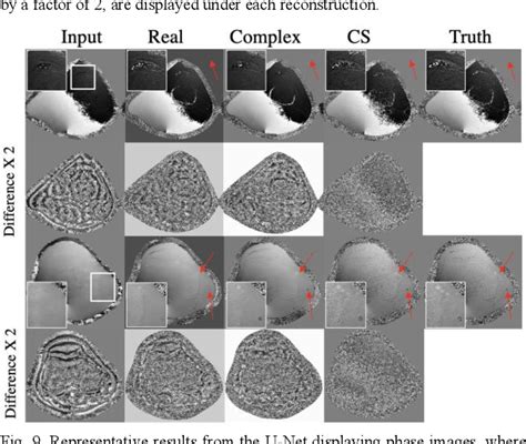 Figure 9 From Analysis Of Deep Complex Valued Convolutional Neural Networks For Mri