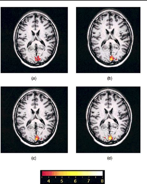 Human Brain Mapping 62833001998 Modeling Hemodynamic Response For