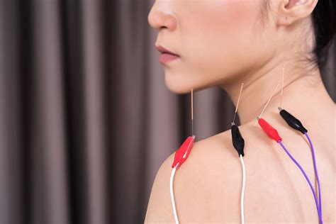 Say Goodbye To Shoulder Pain With Electroacupuncture El Paso Tx