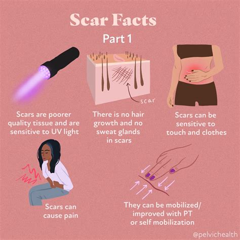 Scar Facts All You Need To Know For Healing Phrc
