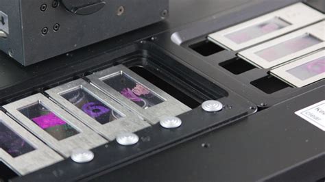 Digital Whole Slide Imaging System