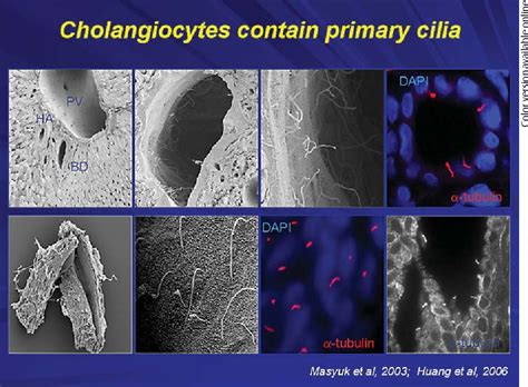 Figure 1 From The Role Of Cilia In The Regulation Of Bile Flow
