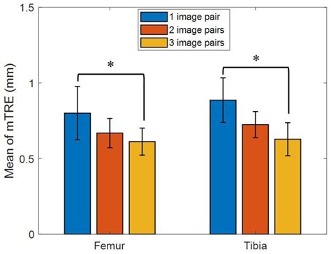 Integration Of Statistical Shape Modeling And Alternating Interpolation Based Model Tracking