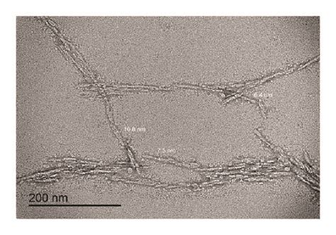 Tem Images And Diameter Distribution Of Cncs A Individualized Cncs