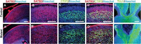 Normal Specification Of Callosal And Corticospinal Projection Neurons Download Scientific