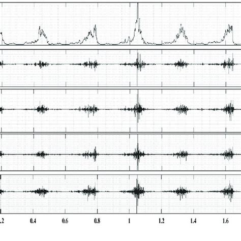 Pdf Comparative Analysis Of Svm And Naive Bayes Classifier For The Semg Signal Classification