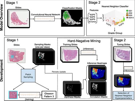 Development And Validation Of A Deep Learning Algorithm For Improving
