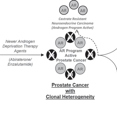 Schematic Representation Of Hypothesized Prostate Cancer Download Scientific Diagram