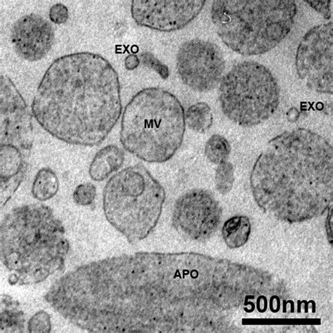 Pdf Differential Detergent Sensitivity Of Extracellular Vesicle Subpopulations