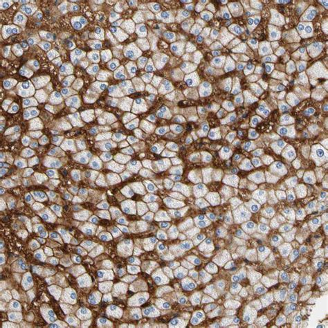 Rabbit Polyclonal Anti Ca14 Antibody Buy For Research Highly Specific Rigorously Validated