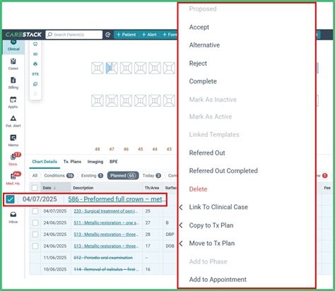 A Guide To The Odontogram Charting Carestack