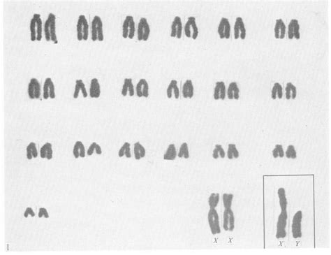Figure 2 From Constitutive Heterochromatin And Karyotype Variation In