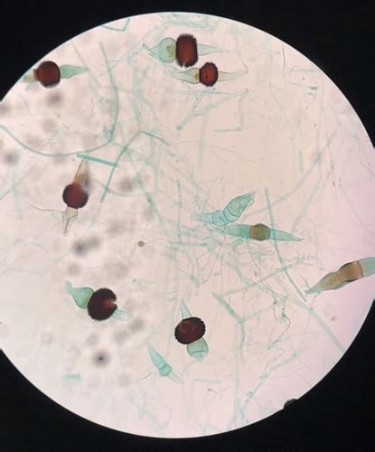 Biology 1b Lab Fungi Flashcards Quizlet
