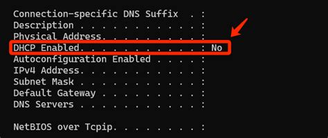 What Is A Static IP Address And How To Get One X VPN