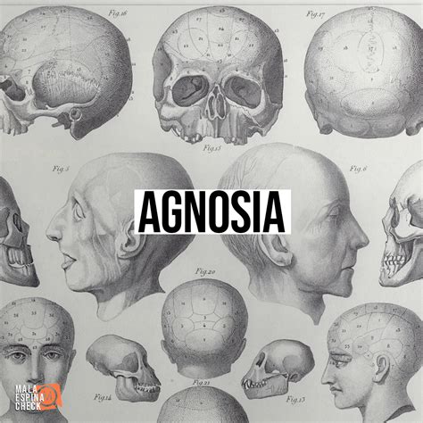 ¿qué Es La Agnosia La Condición Que Se Le Atribuyó Al Presidente