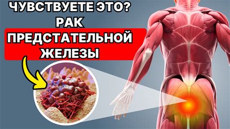 Рак предстательной железы 10 ранних признаков и симптомов Не игнорируйте Youtube