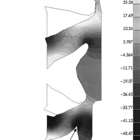 Pressure Fringe Plot At Nal Load Step Of Initial Design Download Scientific Diagram