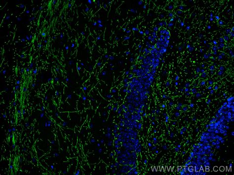 Neural Cell Markers Expanded Antibody Kit Pk30027 Proteintech