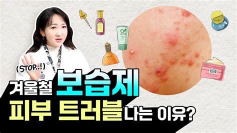 무조건 비싸다고 피부에 좋은 보습제 일까 ㅣ 보습제 ㅣ 피부보습제 ㅣ 겨울철보습제 Youtube