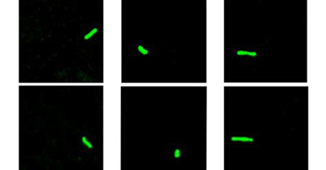 Protein Interactions Important To Syngap1 Related Conditions And More