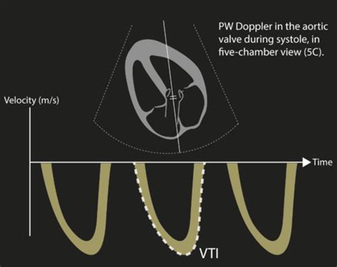 Chapter 6 Lv And Rv Systolic Function Flashcards Quizlet